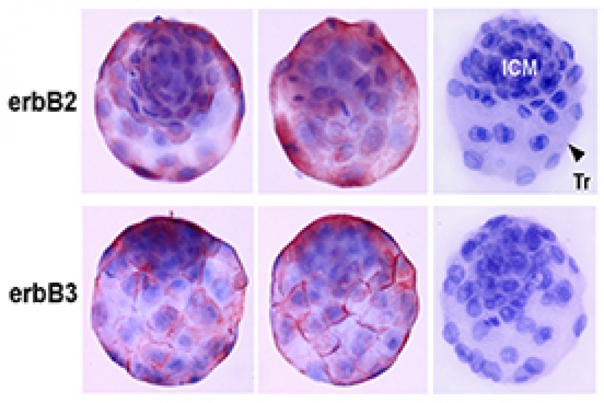 Neonatology Research | Department of Pediatrics