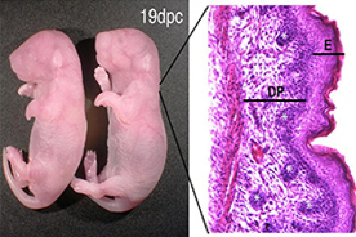 Neonatology Research | Department of Pediatrics